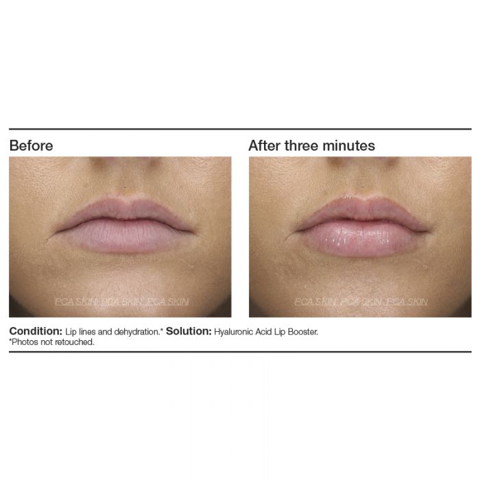 PCA Skin Hyaluronic Acid Lip Booster – skinBEAUTIFUL RX